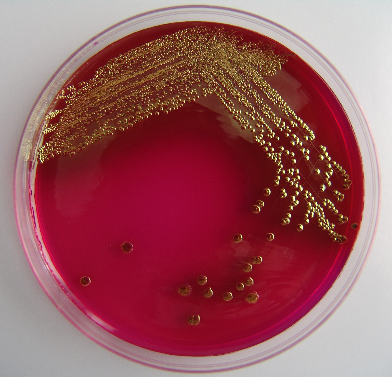Escherichia Coli Infection E Coli 